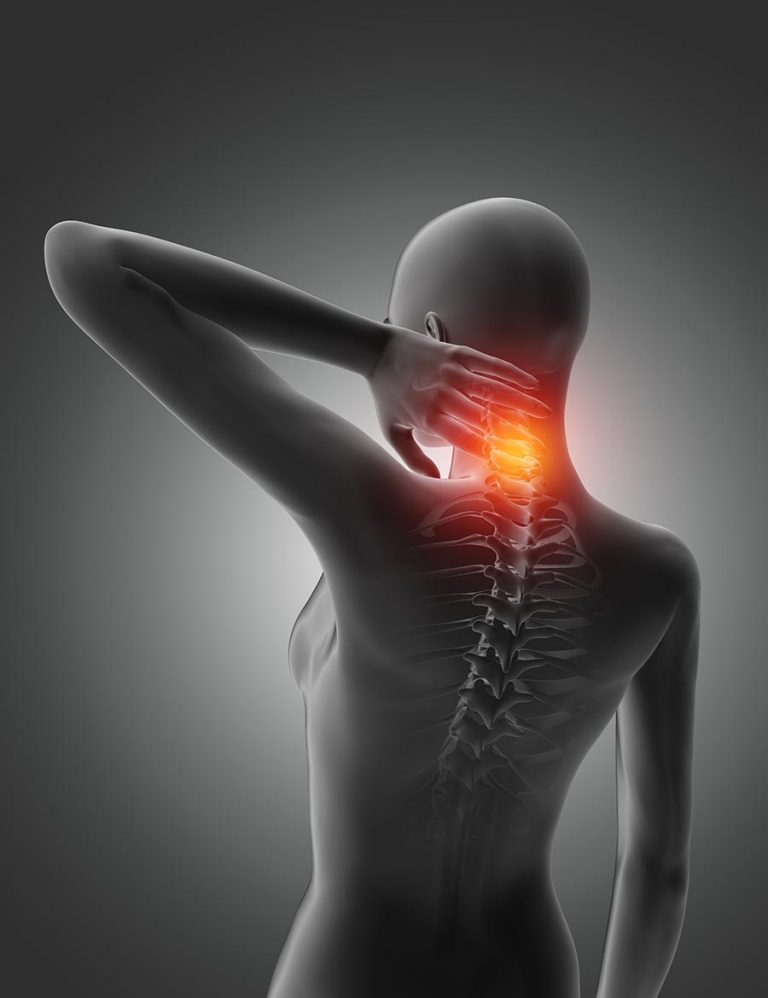 Cervical Spondylosis Treatment in Fairfax, VA and Potomac, MD | Spine ...