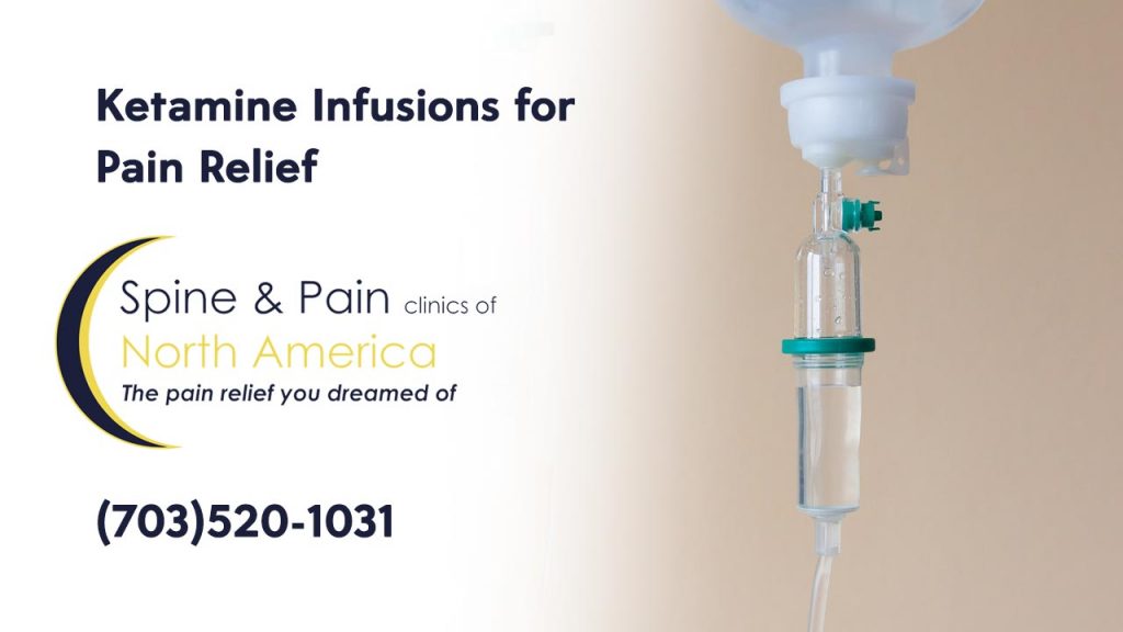 Ketamine Infusions at SAPNA: Spine and Pain Clinic of North America ... Ketamine Infusions at SAPNA: Spine and Pain Clinic of North America ...