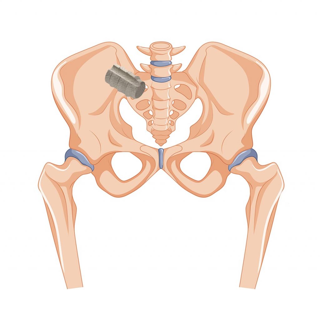 Pain Treatments at SAPNA: Spine and Pain Clinic of North America ...