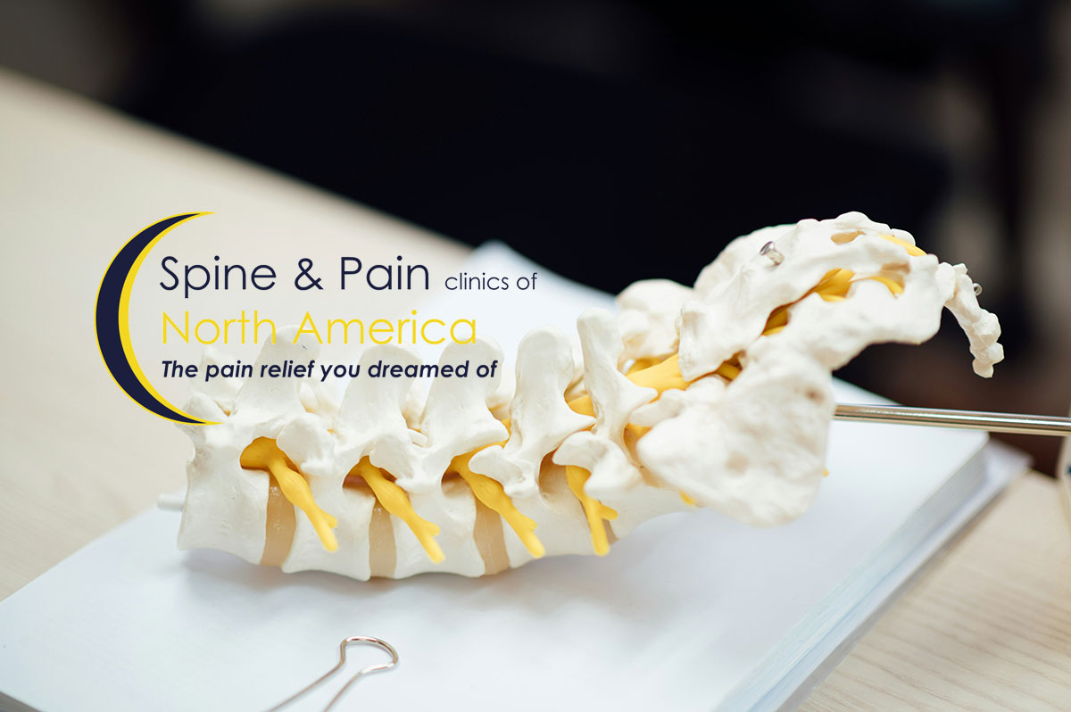 What is a Nerve Root? - Spine and Pain Clinics of North America